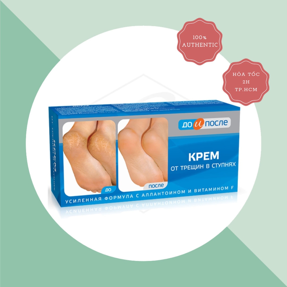 Kem Trị Nứt Gót Chân Kpem Nga - 50ml - Sbiz